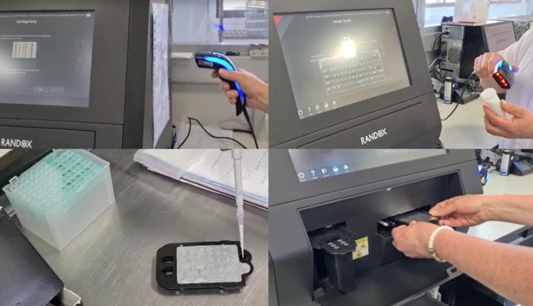 Disponible el nuevo método Infiniplex Randox para la detección de ...